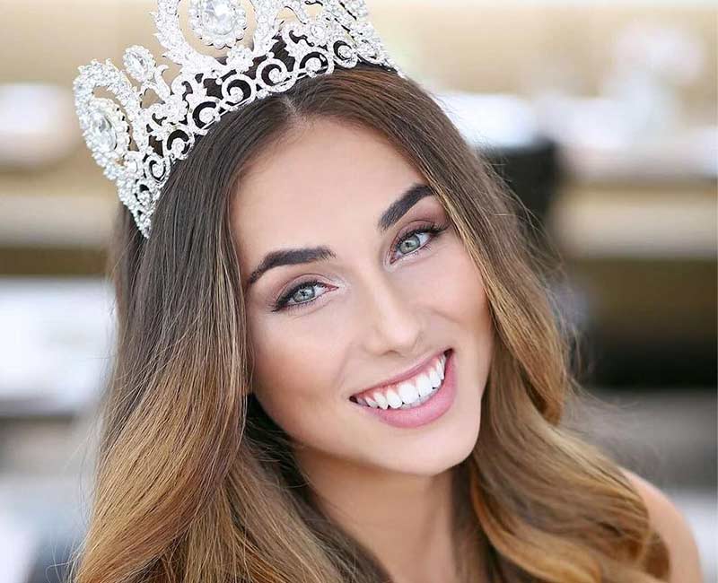 Search for Czech Miss 2018 is on | Angelopedia